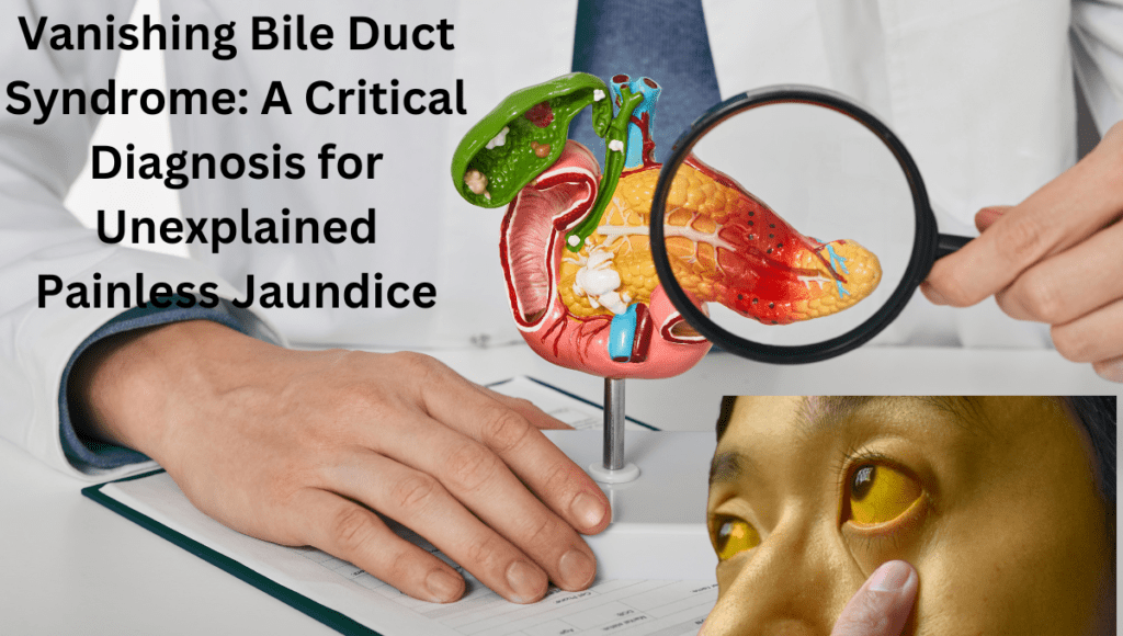 Vanishing Bile Duct Syndrome: A Critical Diagnosis for...